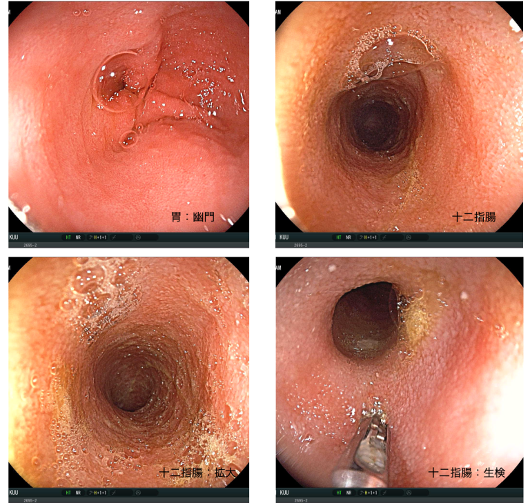 消化器疾患シリーズ5：高齢犬の慢性下痢 | アリイ動物病院