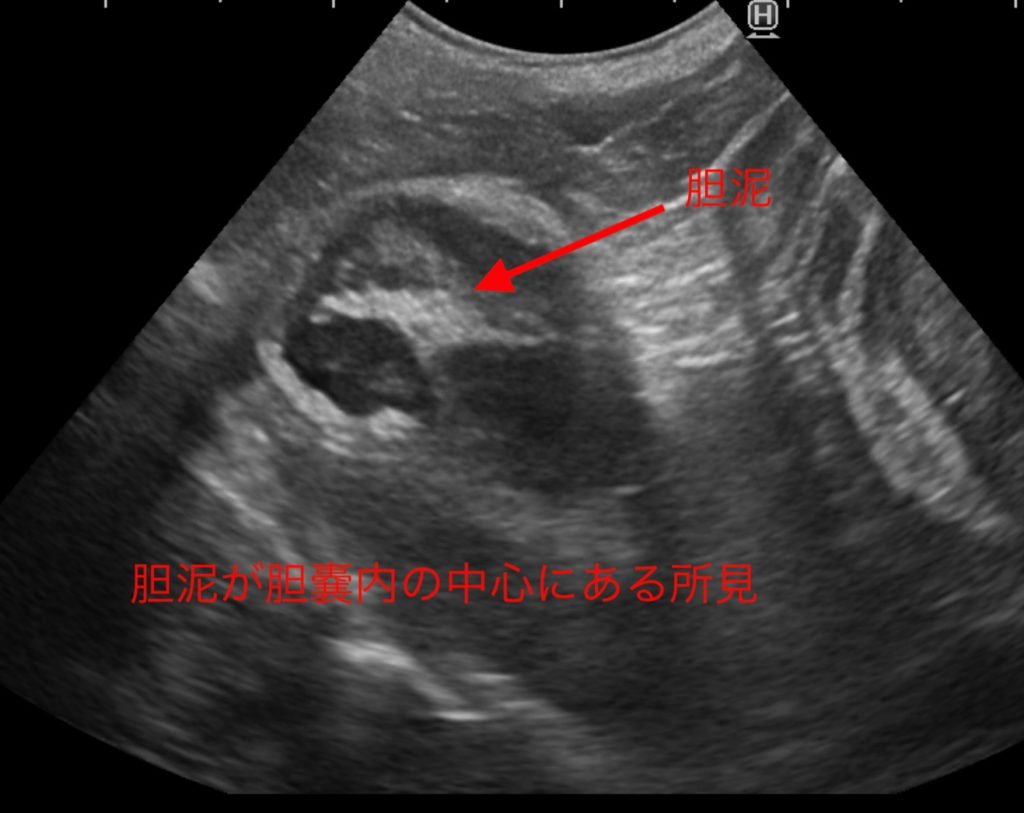 消化器疾患シリーズ8：犬の胆嚢粘液嚢腫 | アリイ動物病院